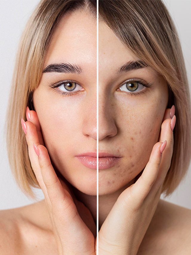 Types of Skin Whitening Treatments | Benefits of Skin Whitening - Alive ...